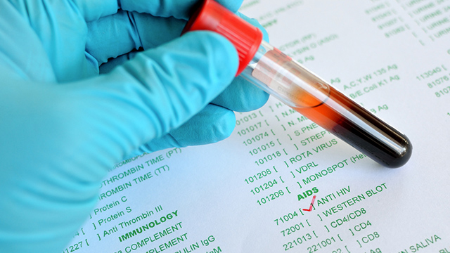 'The HIV Generation': 25 people get infected daily in PH